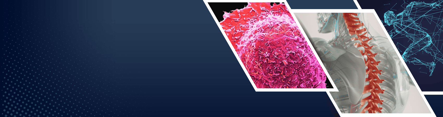 Orthopaedic Surgery Research | Orthopaedic Surgery